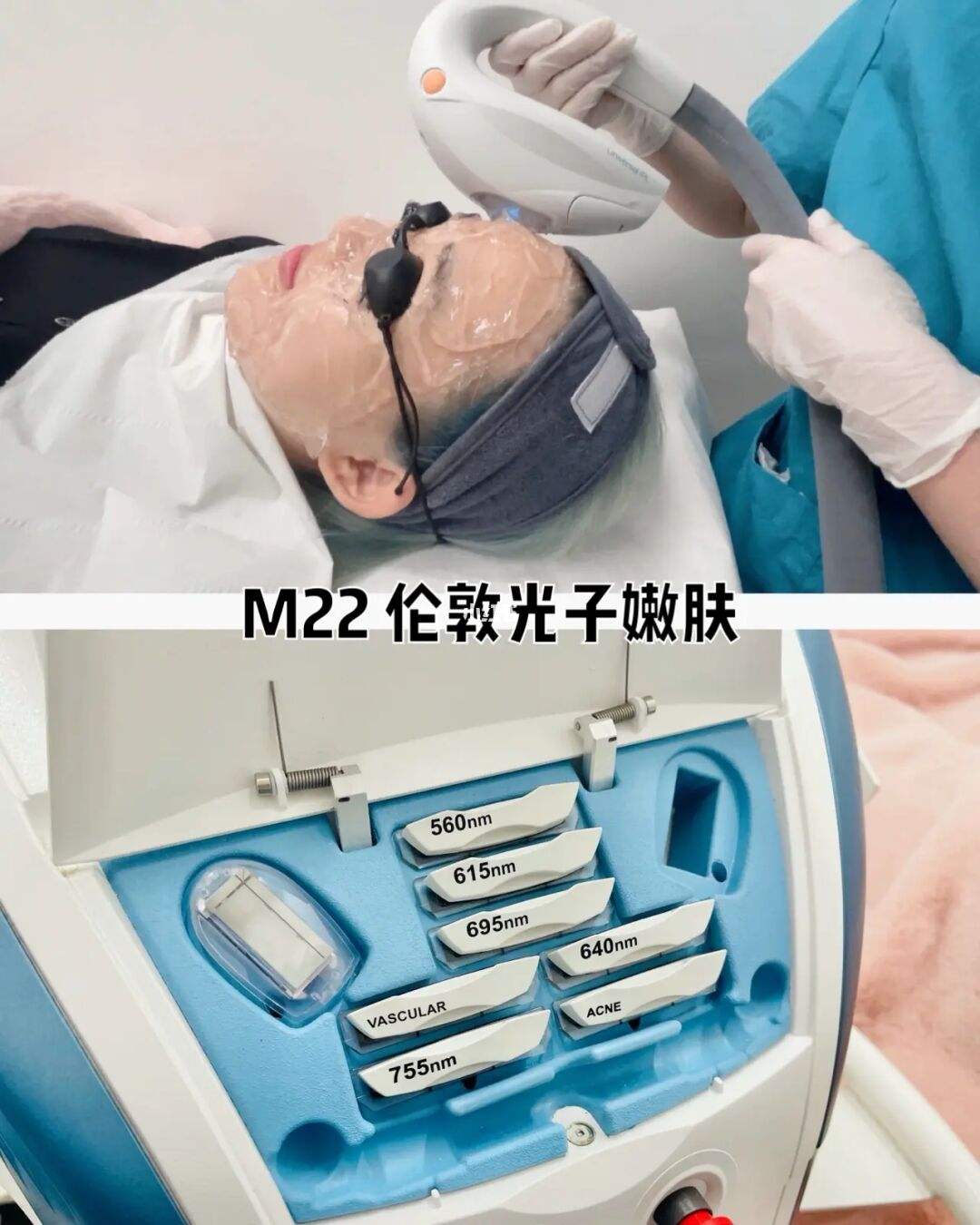上海丽园医美：光子嫩肤M22与DPL到底有什么区别_潘伟_主治医师_爱问健康