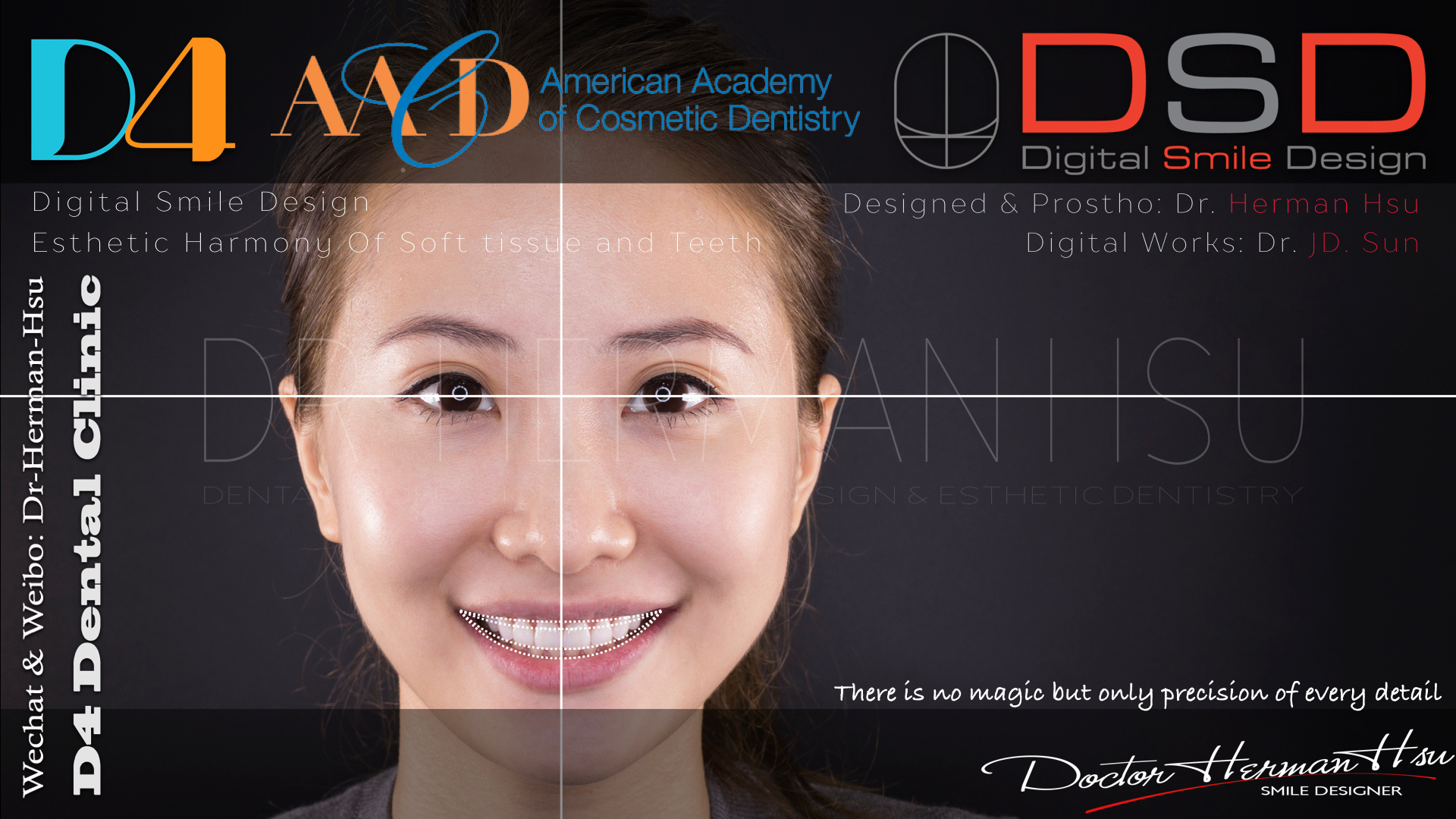 什么是DSD设计？_许恒恺_住院医师_爱问健康