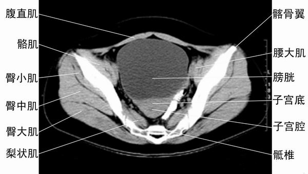 CT值(HU.)的概念！_崔小华_住院医师_爱问健康