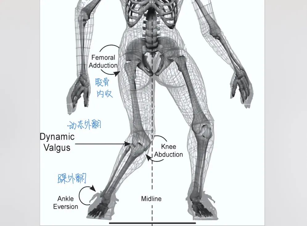 科学解读下肢力线：如何改善X型腿和O型腿？_陈博闻__爱问健康